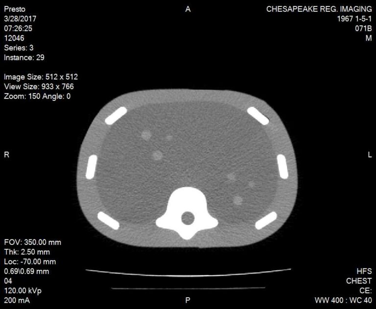 Image-Guided Abdominal Biopsy Phantom (model 071B) - CIRS - PEO Medical
